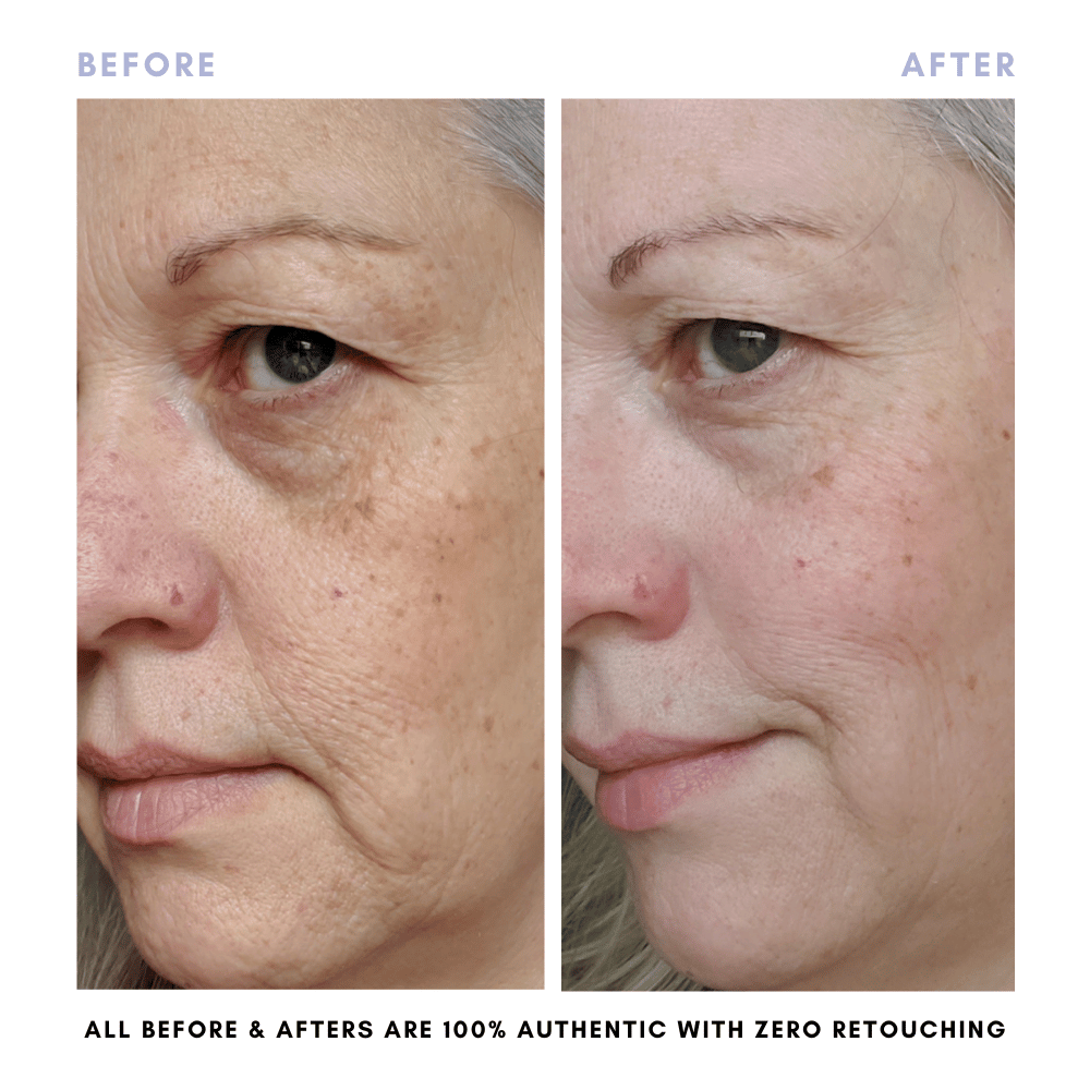 Affordable Acne Skin Care | Balancing Oil - Clover by Clove + Hallow